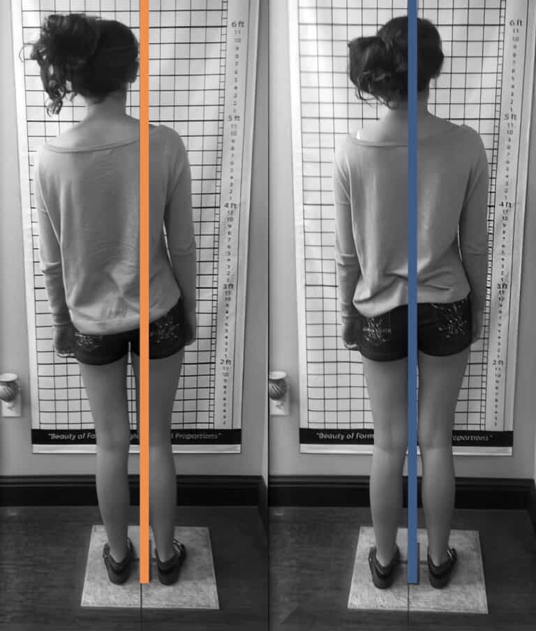 Fix your body’s chronic pain with a free online posture analysis ...